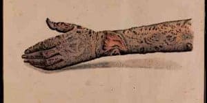 Medieval Diseases - The Black Death, Bubonic Plague and Other Medieval ...